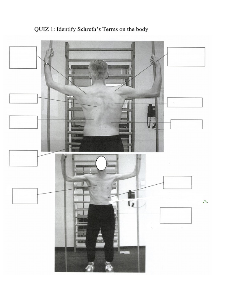 QUIZ 1: Identify Schroth's Terms On The Body | PDF