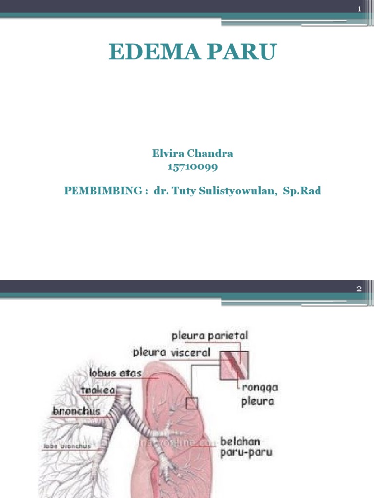 Edema Pulmonum Elvira Chandra | PDF