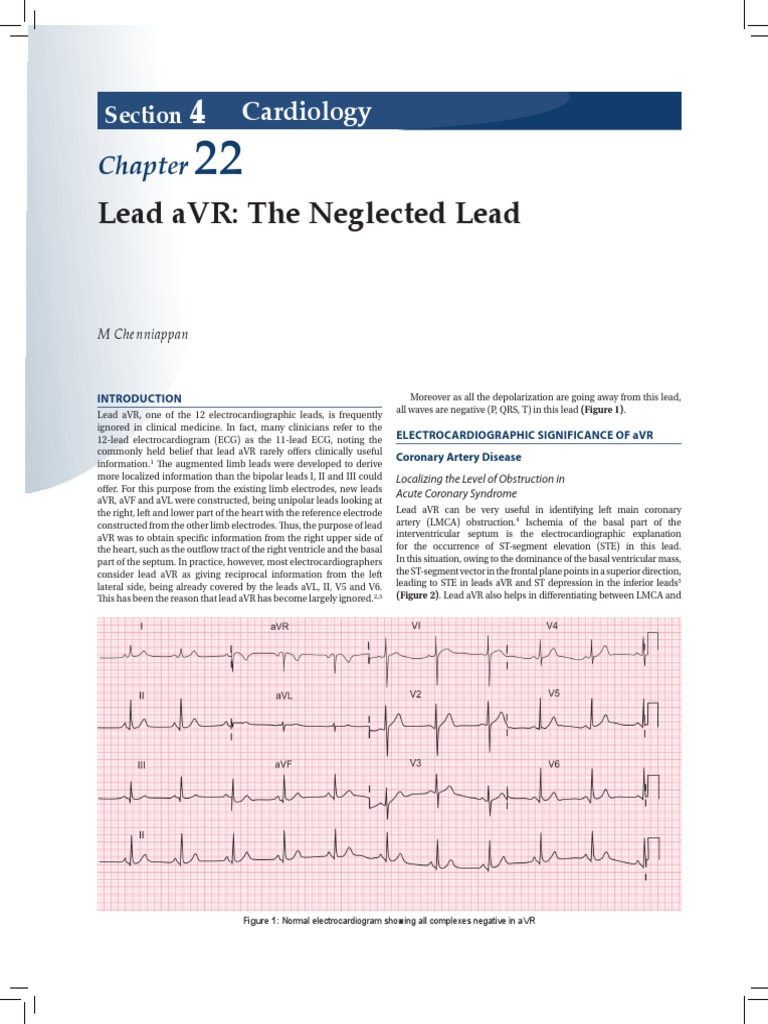 Clinical Importance of Lead aVR in ECG | PDF | Electrocardiography ...