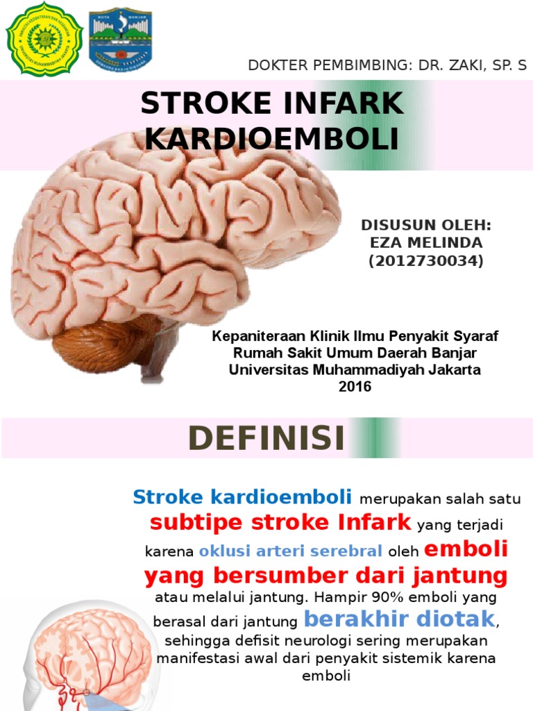 Referat - Stroke Infark Kardioemboli | PDF