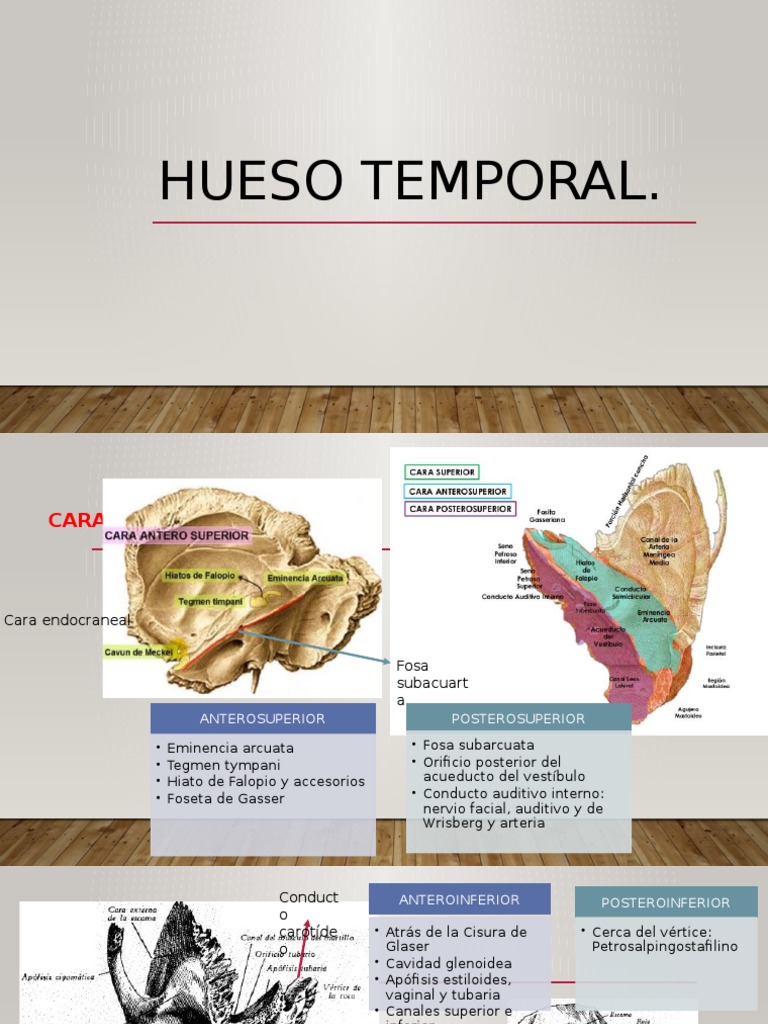 Anatomía de la cara endocraneal del hueso temporal | PDF | Sistema ...