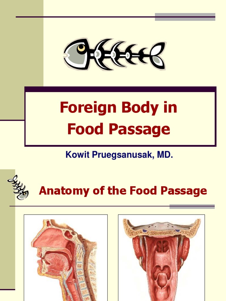 ENT - Foreign Body in Food Passage PDF | PDF