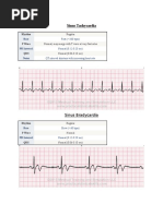 EKG Practice Test | PDF | Myocardial Infarction | Artificial Cardiac ...
