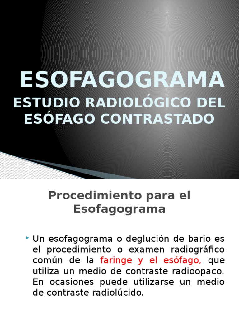 ESOFAGOGRAMA | PDF | Esófago | Cáncer de esófago