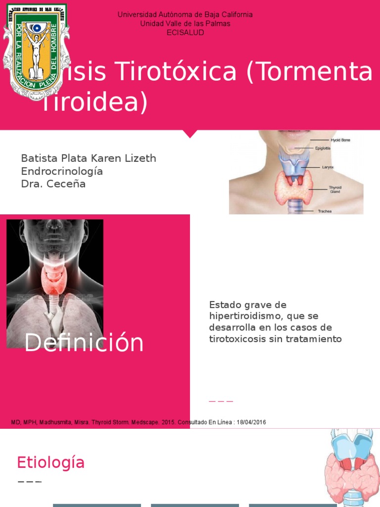 Crisis Tirotóxica (Tormenta Tiroidea): Definición, Etiología ...