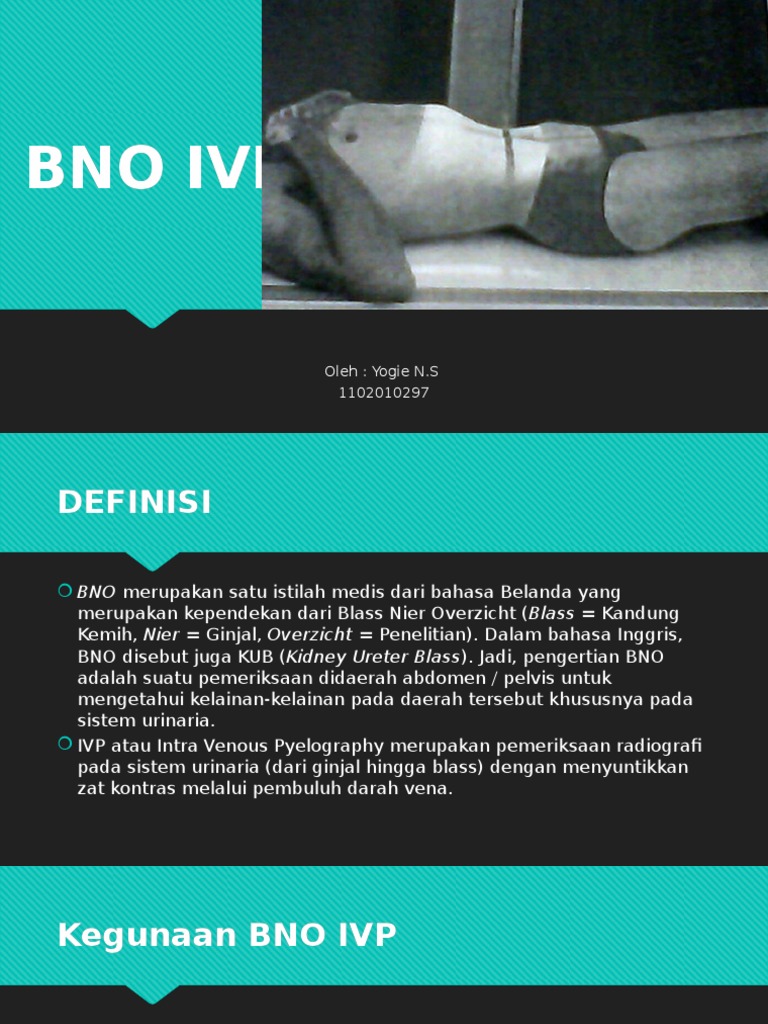 Bno Ivp | PDF
