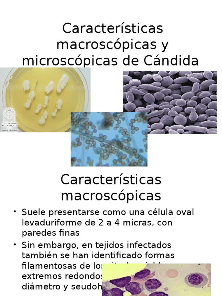 Características Macroscópicas y Microscópicas de Cándida | PDF
