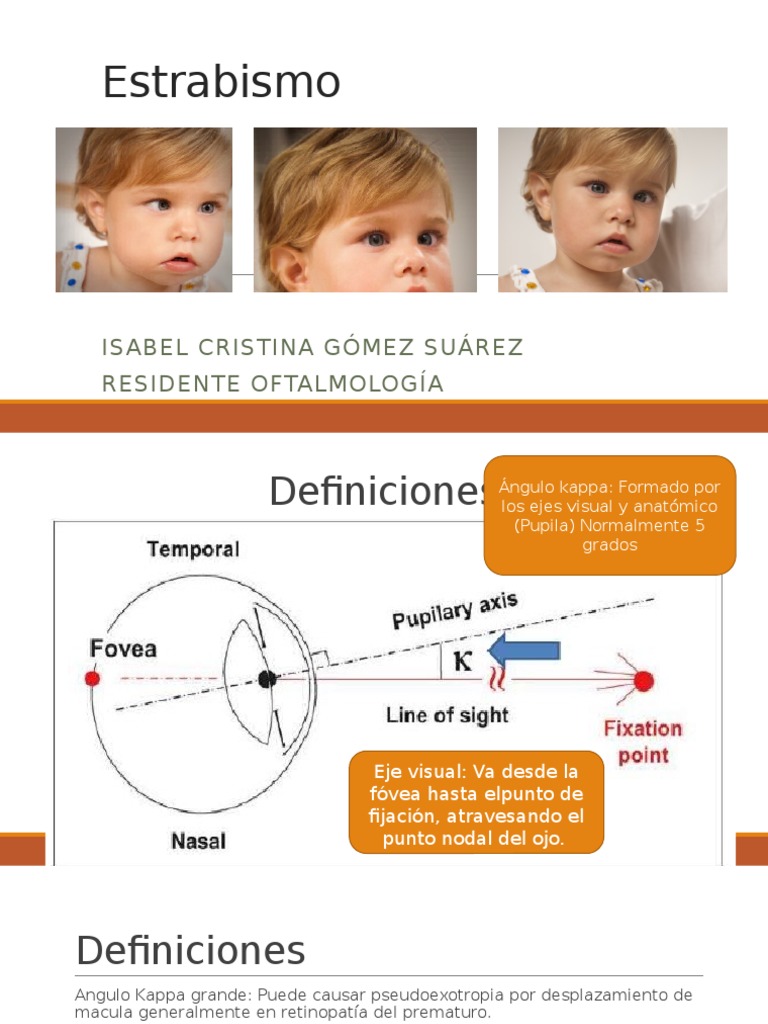 Estrabismo | PDF | Percepción visual | Visión