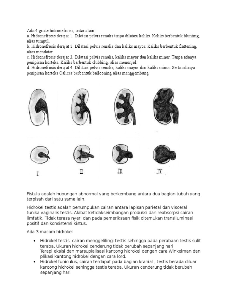 Ada 4 Grade Hidronefrosis | PDF