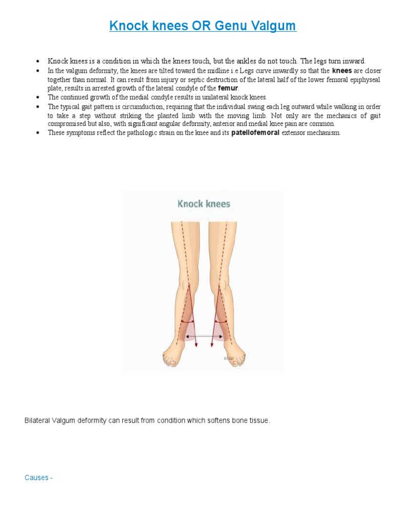 Genu Valgum | PDF | Knee | Human Leg