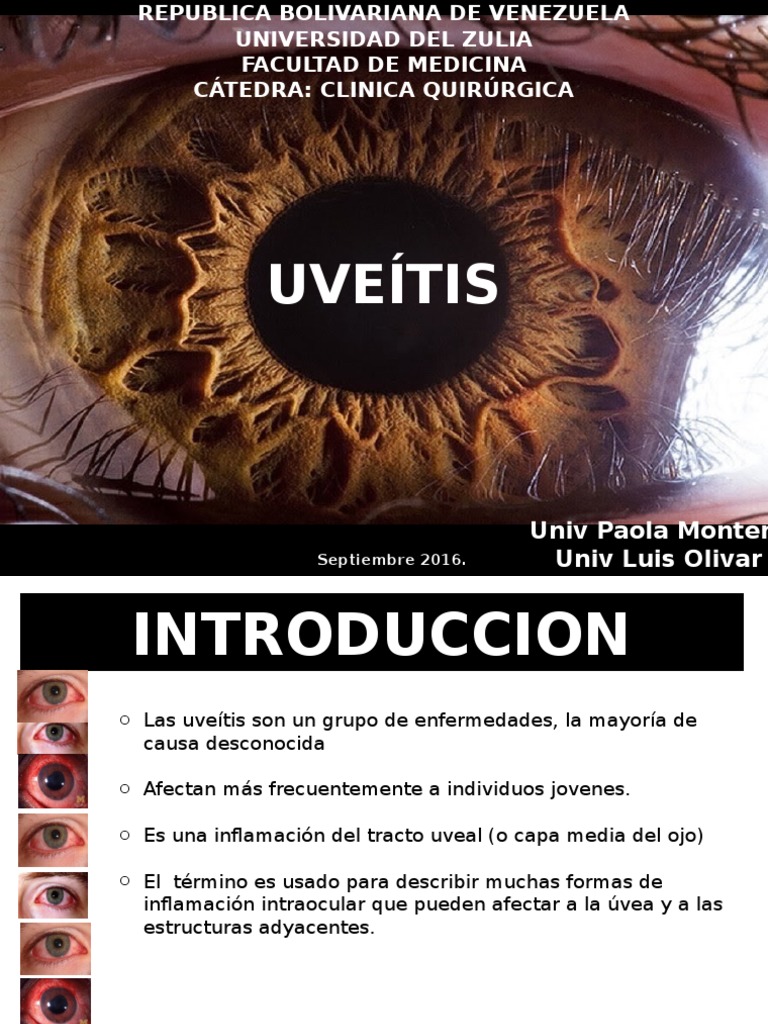 Uveitis | PDF | Ojo humano | Ciencias de la Salud