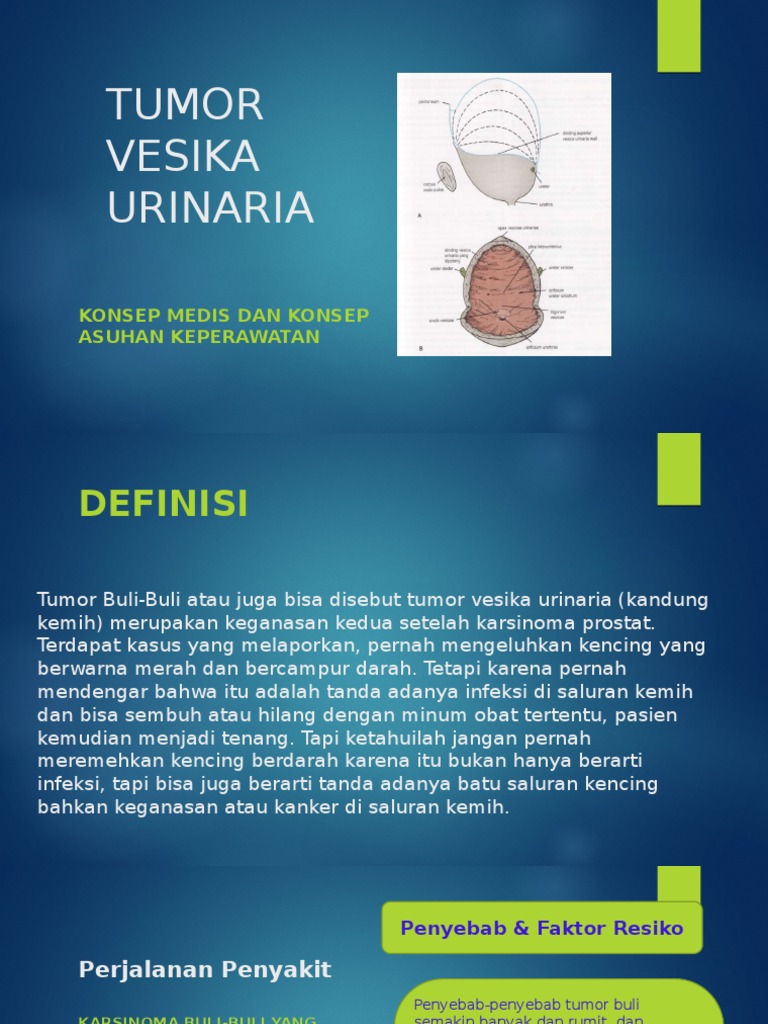 Tumor Vesika Urinaria | PDF