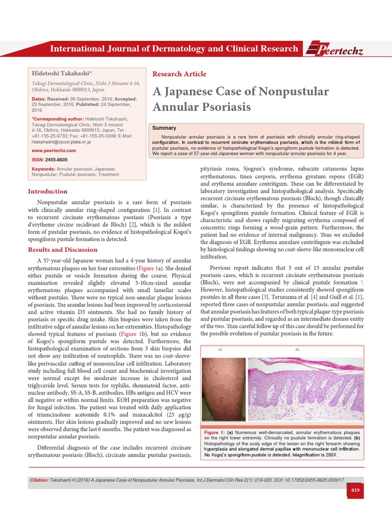 A Japanese Case of Nonpustular Annular Psoriasis | Psoriasis ...