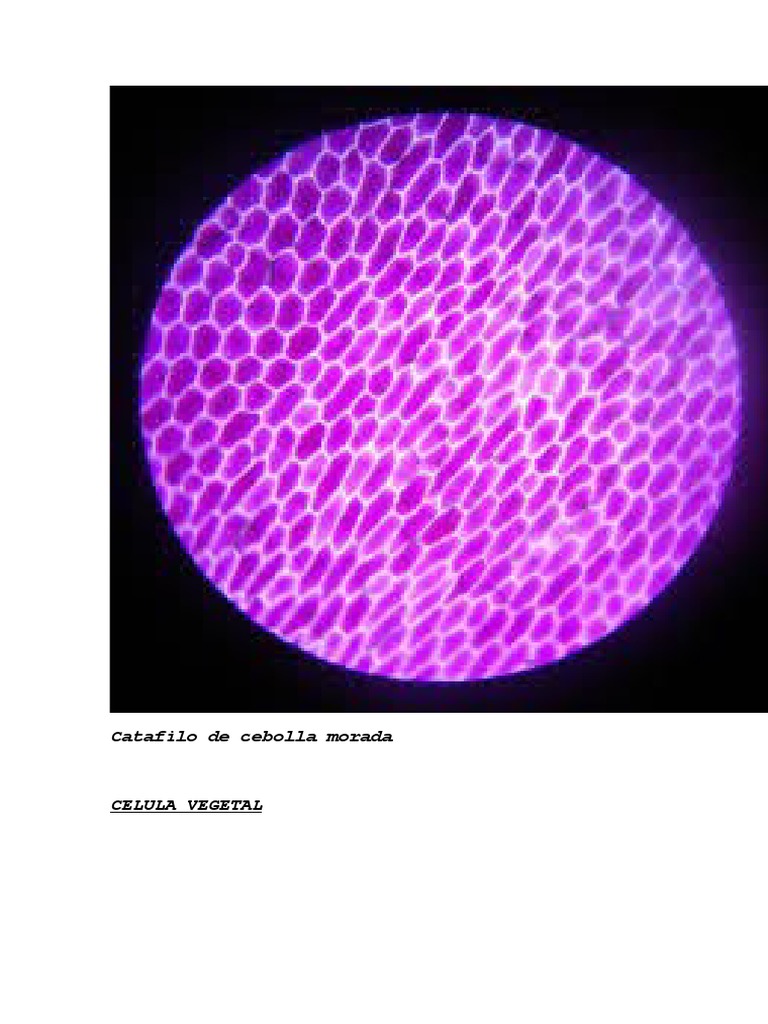 Catafilo de Cebolla Morada | PDF