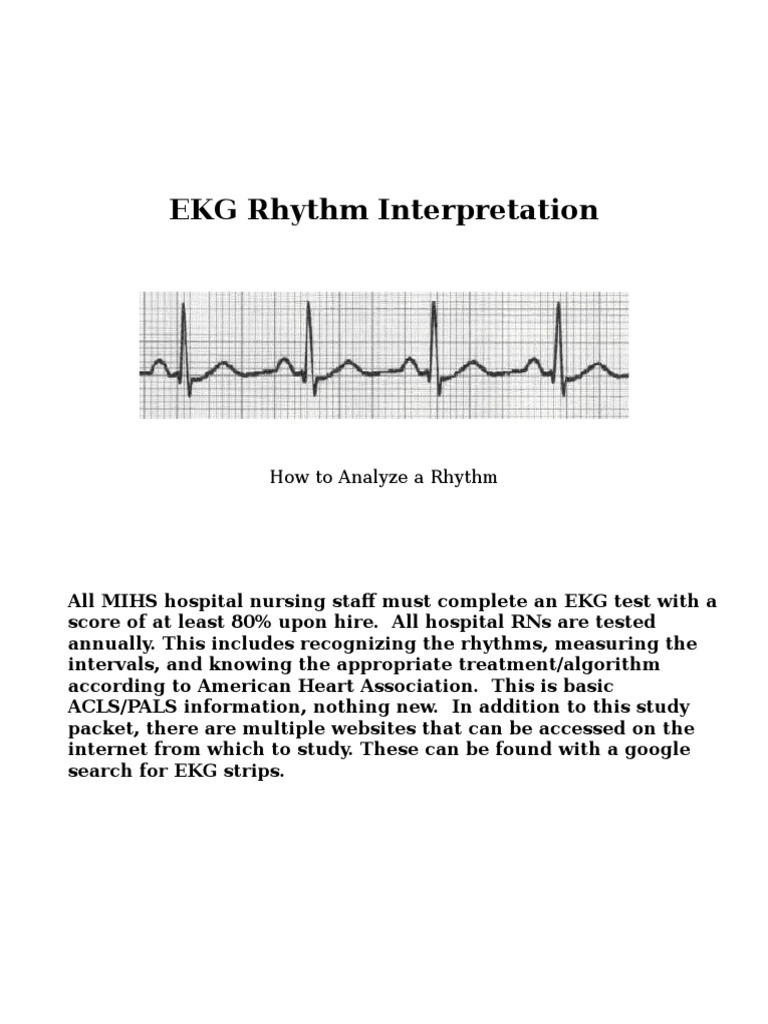 ECG Rhythm Interpretation | PDF