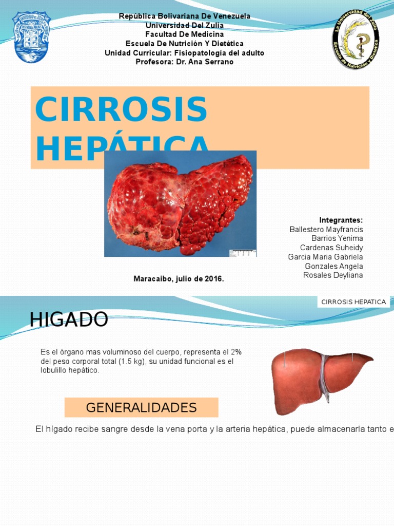 Cirrosis Hepatica Diapositivas | Cirrosis | Hígado