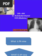 Hilum Overlay Sign in Chest Imaging | PDF