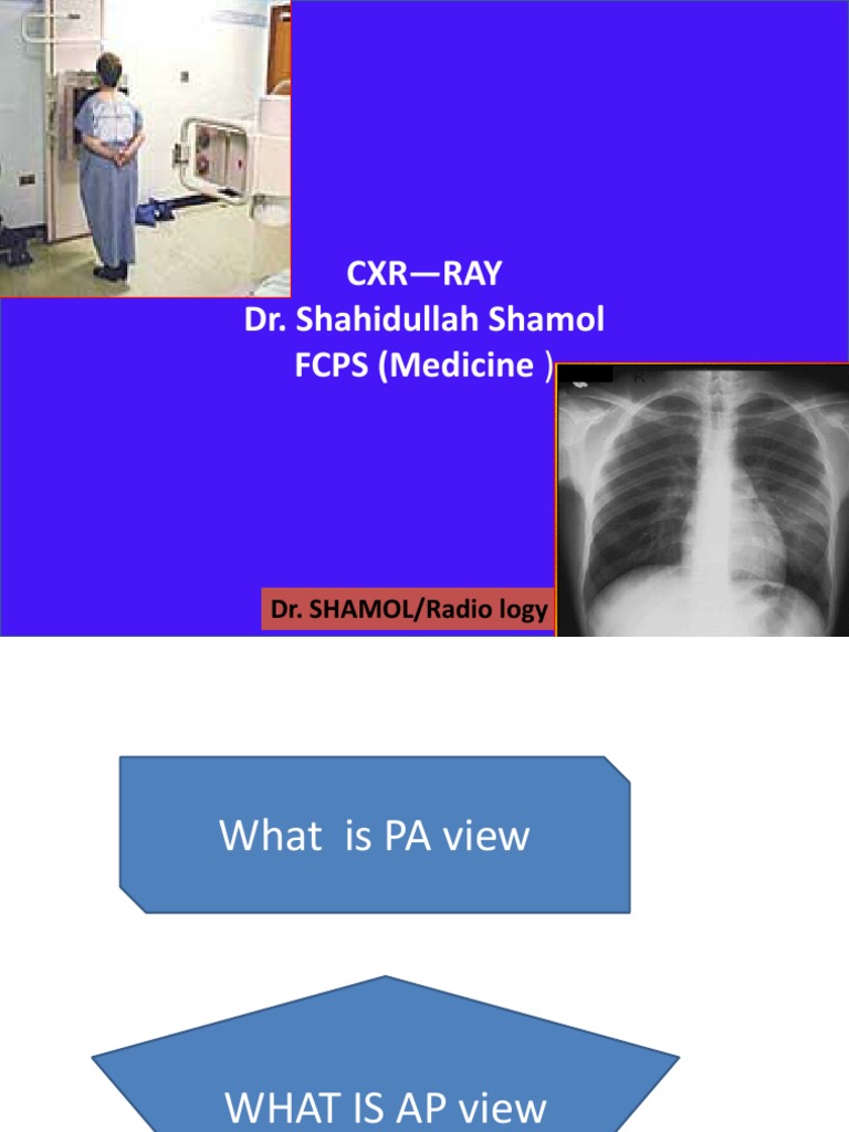 CXR ABC by DR Shamol | PDF | Lung | Heart