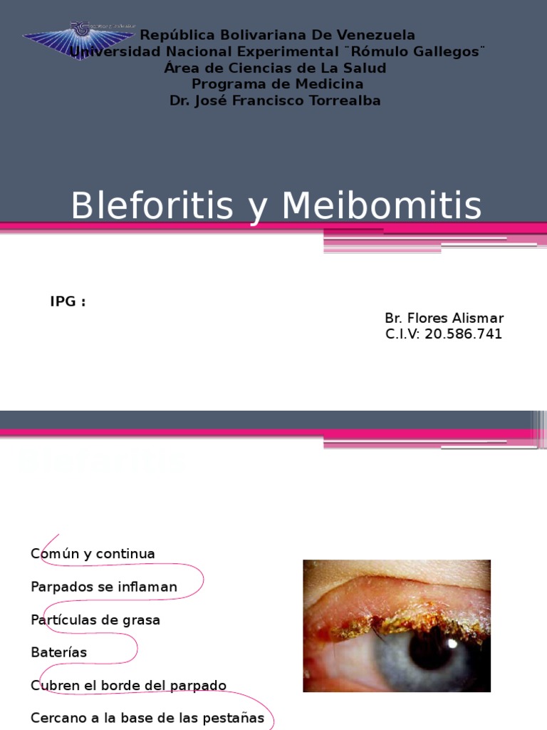 Blefaritis y Meibomitis: Guía Clínica | PDF | Especialidades Medicas ...