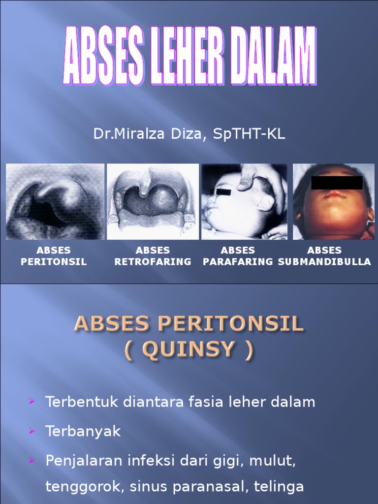 Abses Leher Dalam | PDF