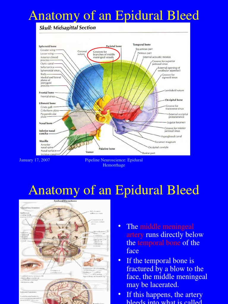 Anatomi Epidural | PDF