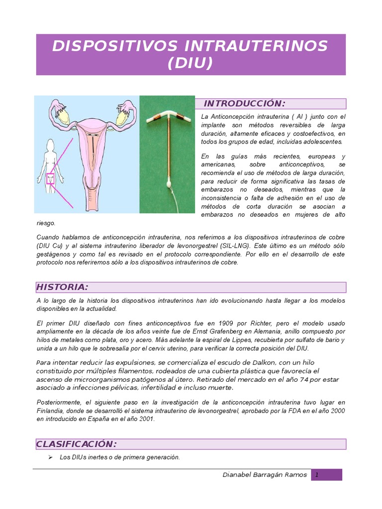 DISPOSITIVOS INTRAUTERINOS | Control de la natalidad | Embarazo
