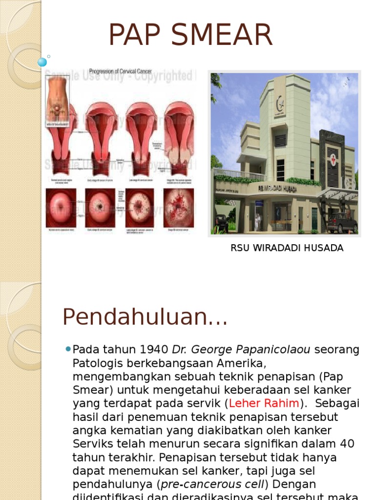 Keuntungan dan Kerugian Pap Smear | PDF | Sains & Matematika