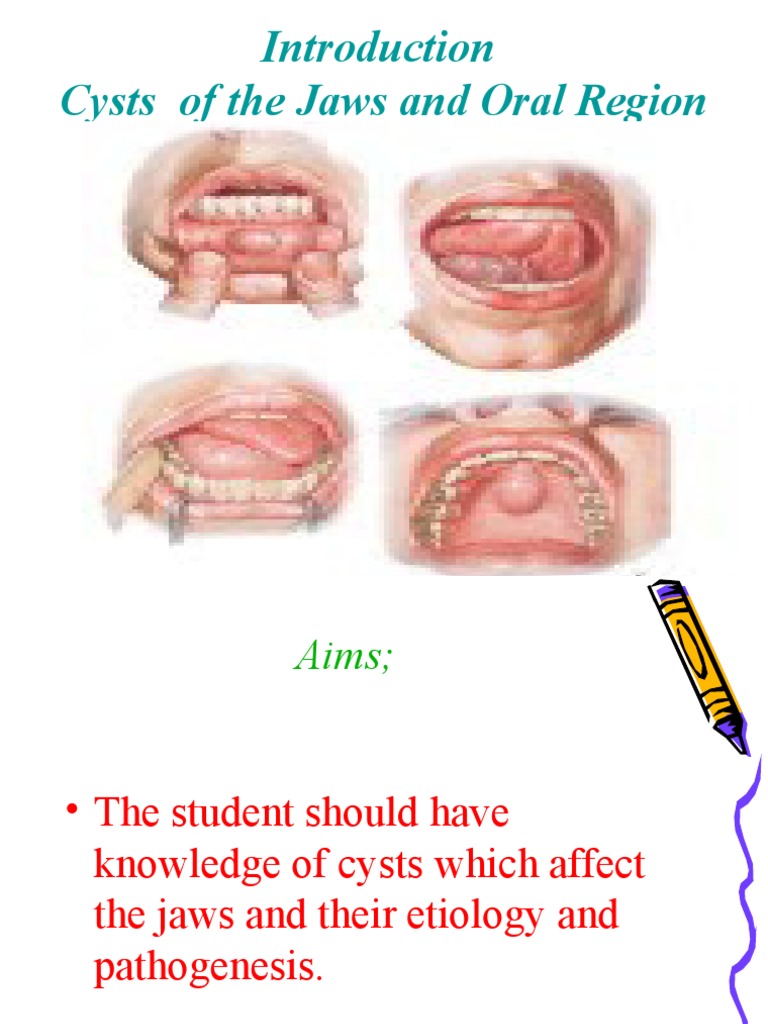 Introduction Cysts of Jaws | Epithelium | Anatomy