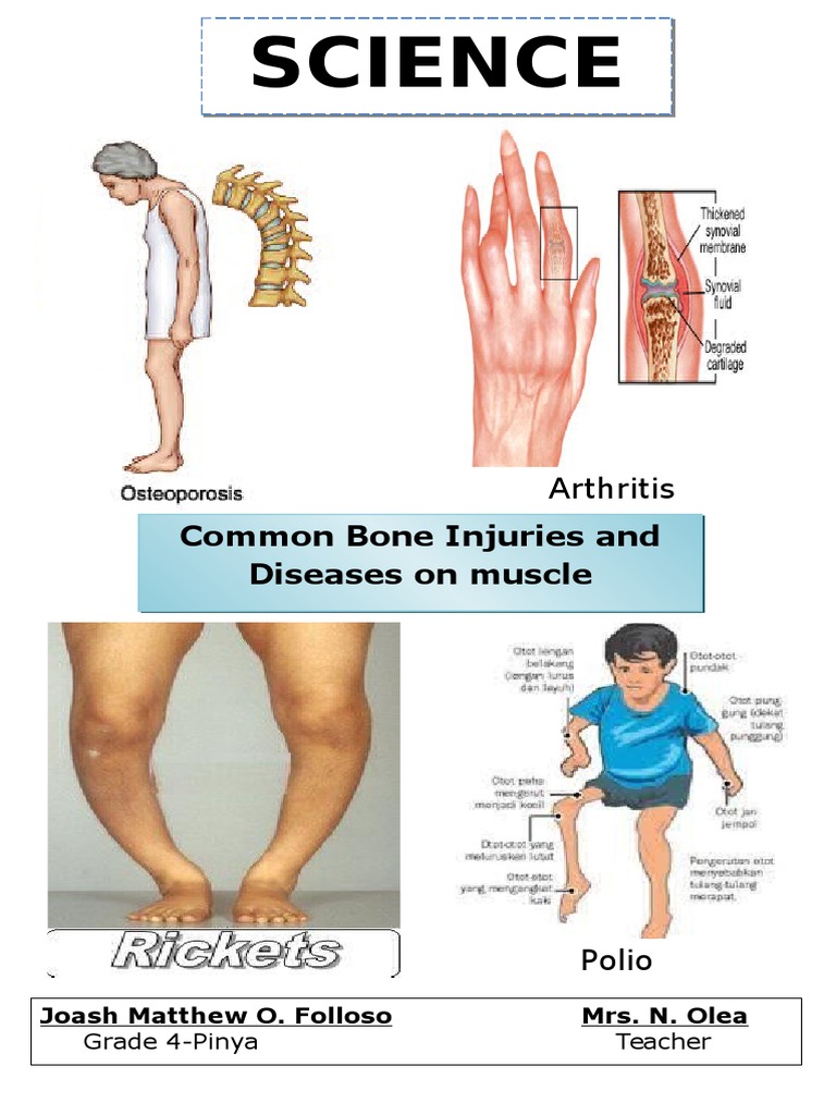 Closed Compound Words | PDF