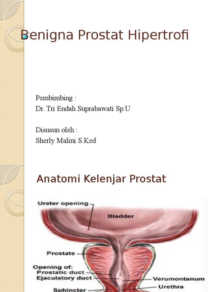 Benigna Prostat Hipertrofi | PDF