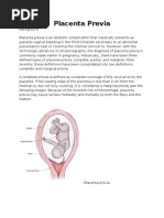 Uterine Synechiae and Pregnancy Complications | PDF | Preterm Birth ...