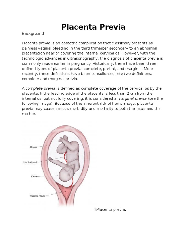Placenta Previa | PDF | Pregnancy | Placenta