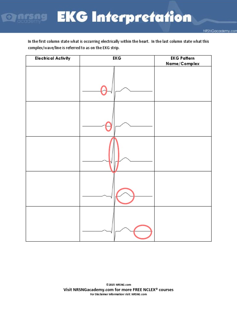 Electrical Activity EKG EKG Pattern Name/Complex | PDF ...