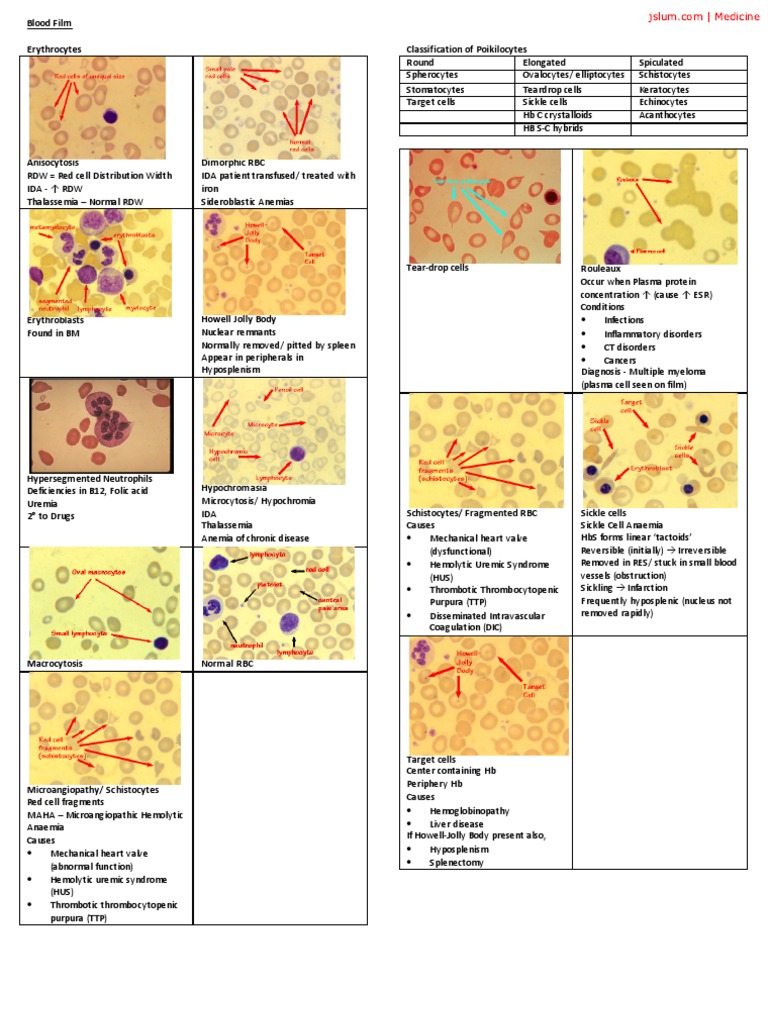 Blood Film | PDF | Anemia | Hematology