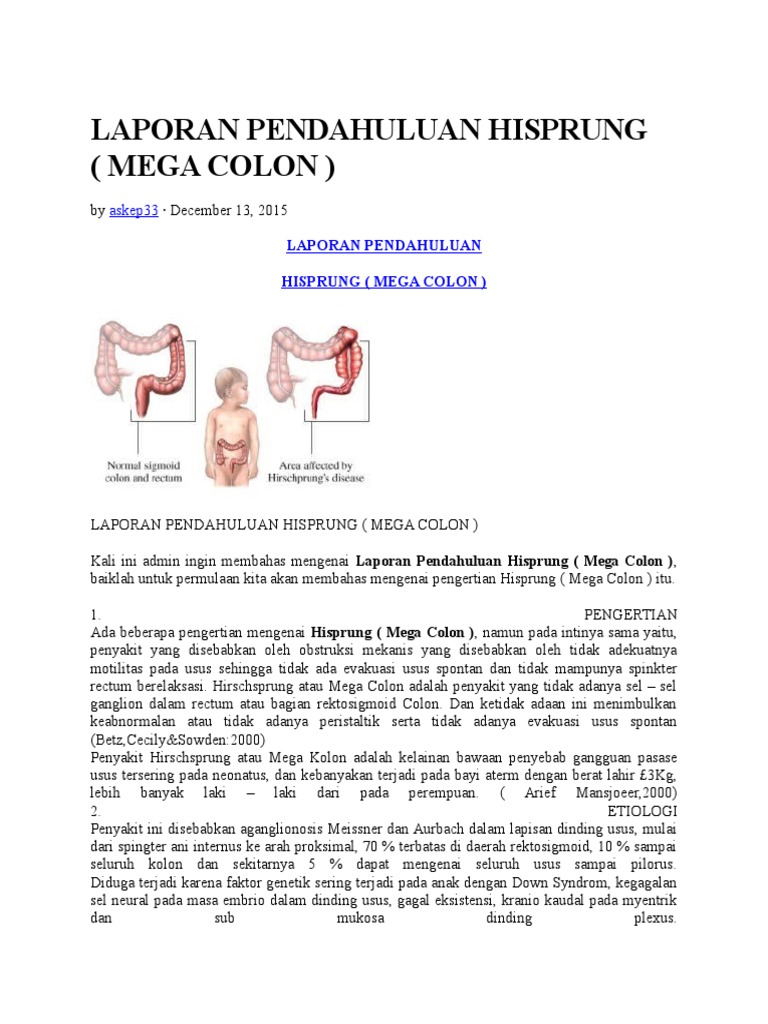 Hisprung 1 Laporan Pendahuluan Hisprung | PDF