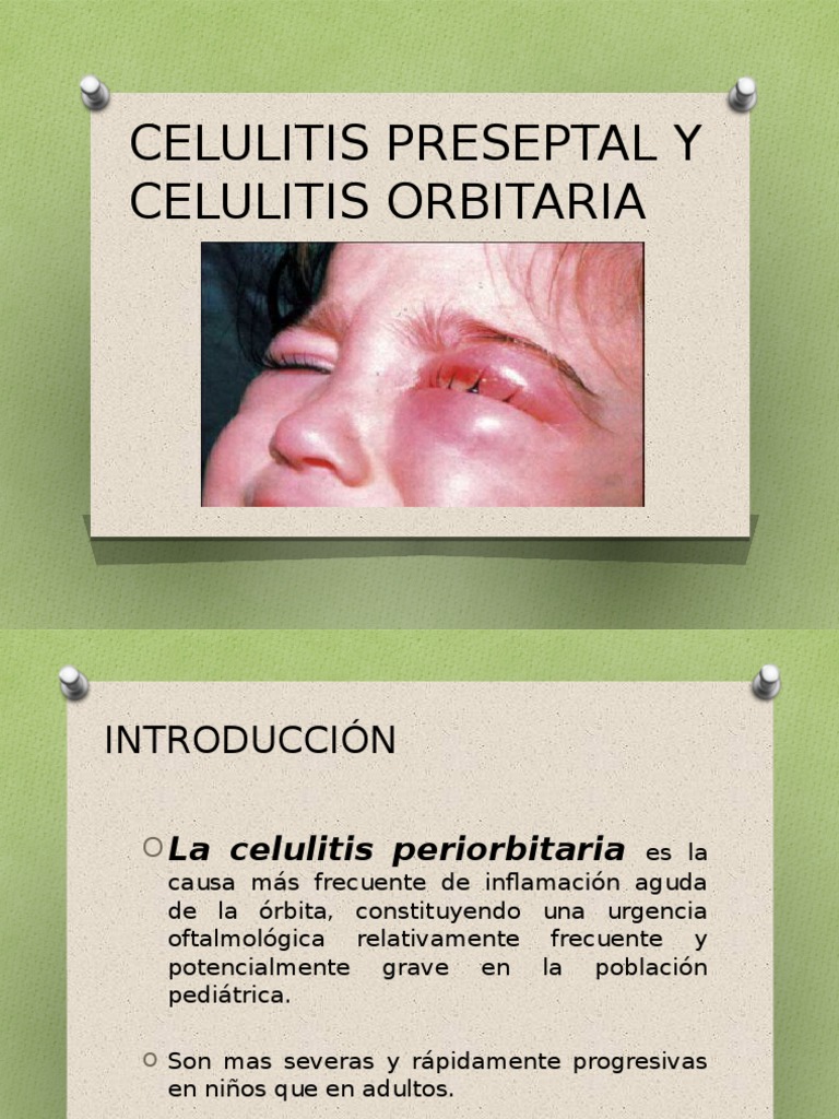 Celulitis Preseptal y Celulitis Orbitaria | Rtt | Medicina