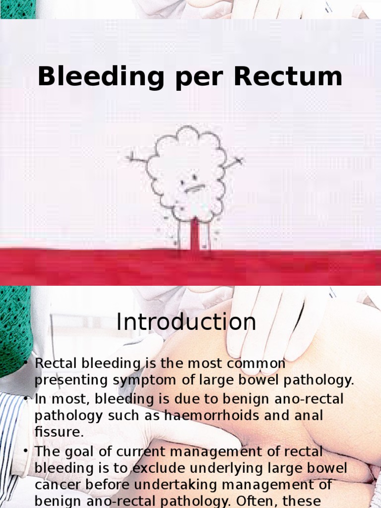 A Comprehensive Guide to the Evaluation and Management of Rectal ...