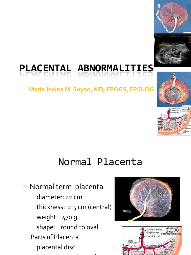 Placental Abnormalities | Placenta | Fetus