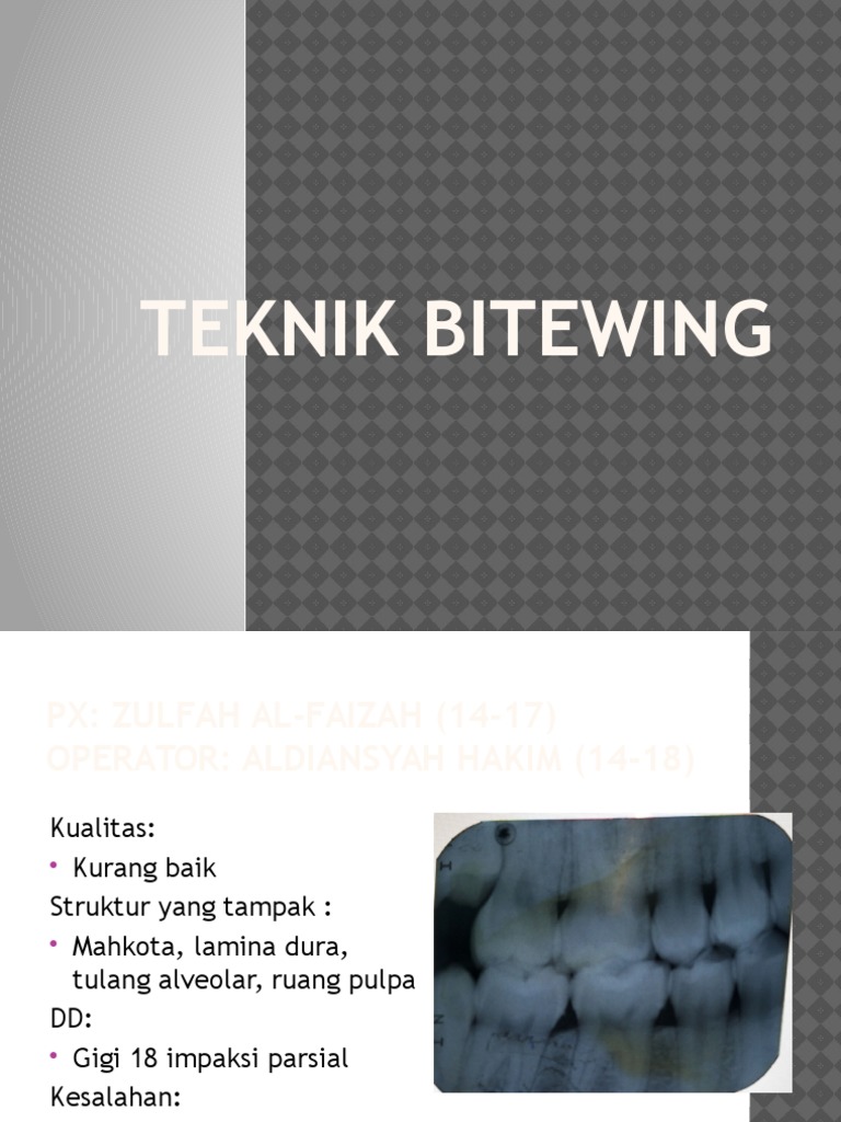 Teknik Radiografi Bitewing dan Interpretasi | PDF | Ilmu Sosial