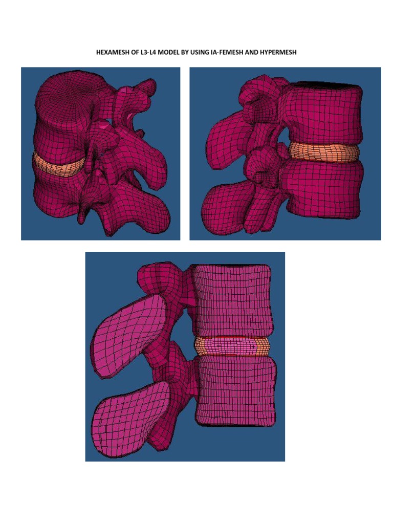 Hexamesh of L3-L4 Model by Using Ia-Femesh and Hypermesh | PDF