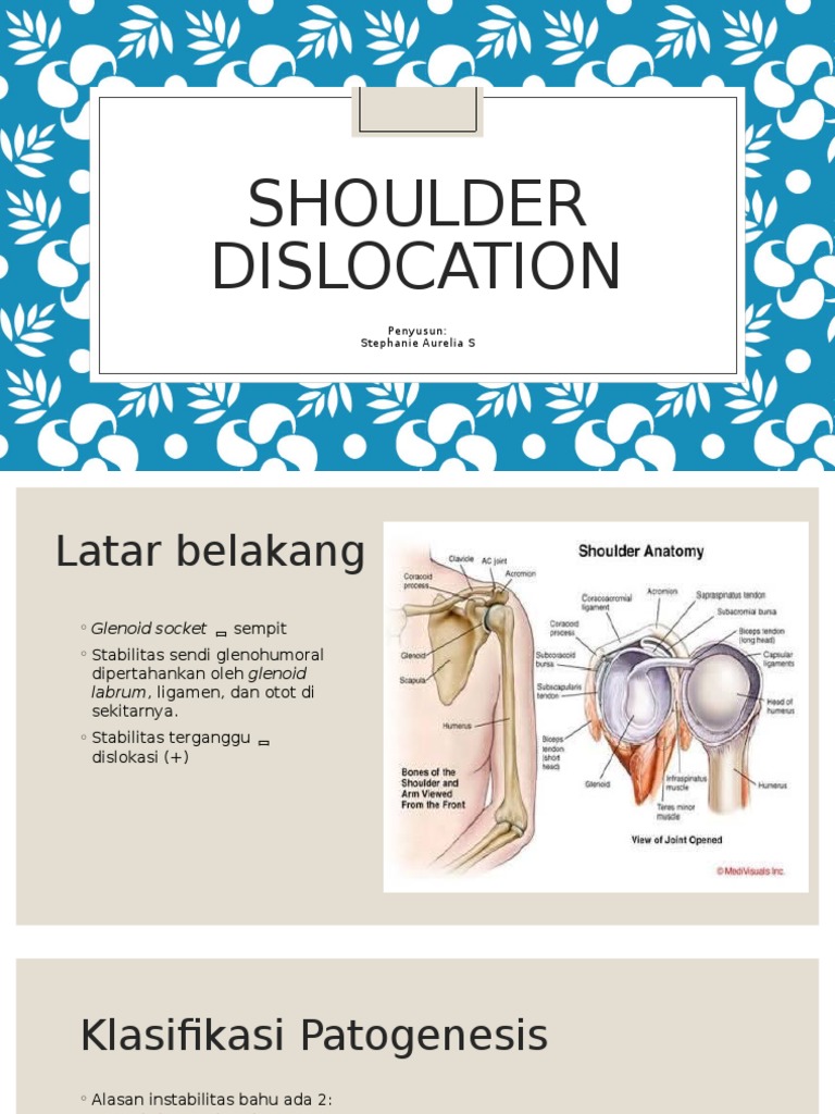 Shoulder Dislocation | Shoulder | Musculoskeletal System