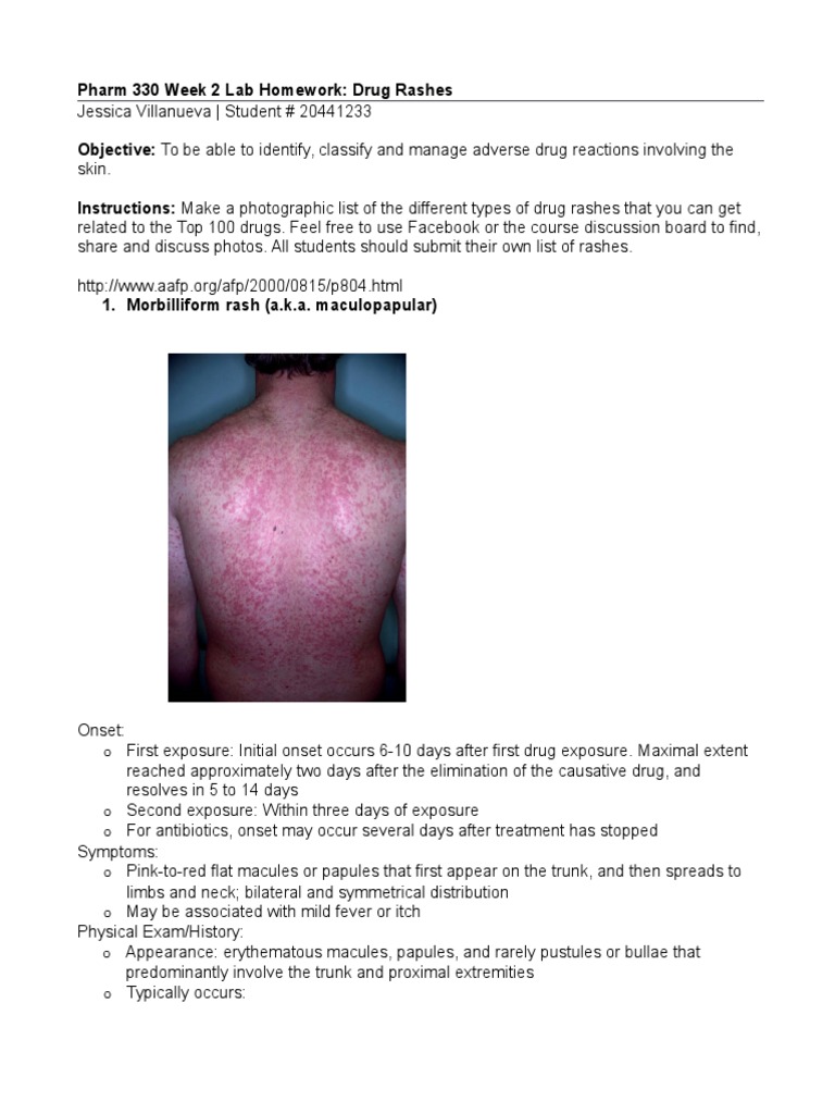 Types of Drug Rashes | Download Free PDF | Dermatology | Clinical Medicine