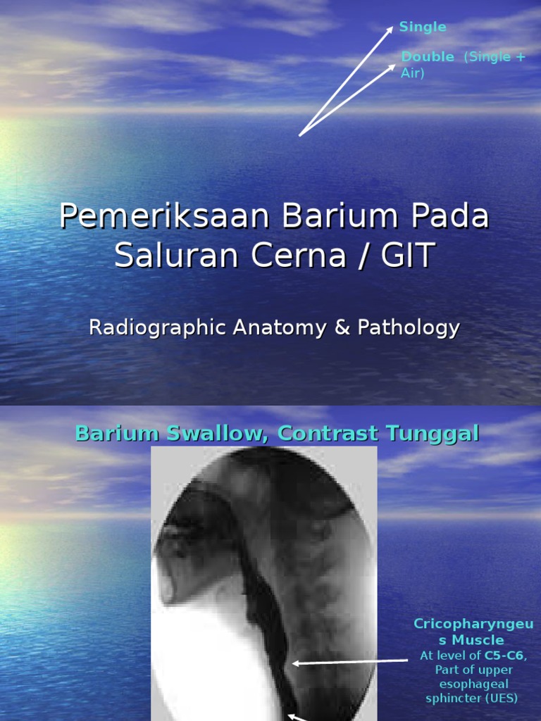 Barium Examination in GIT Radiology | PDF | Esophagus | Large Intestine
