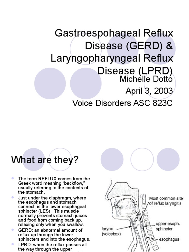 GERD and LPRD: Overview and Treatment | PDF | Gastroesophageal Reflux ...
