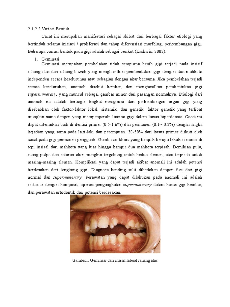 Tugas Pedo Kelainan Jaringan Keras | PDF