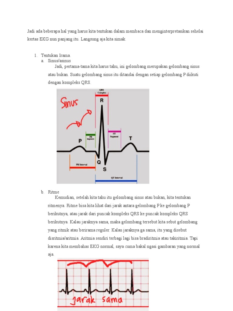 Baca Ekg | PDF