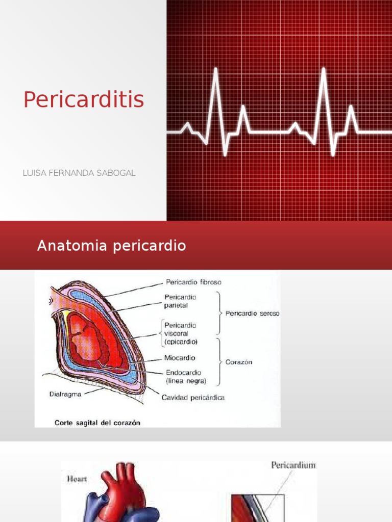 Pericarditis: Causas, Síntomas y Tratamiento | PDF | Medicina CLINICA ...