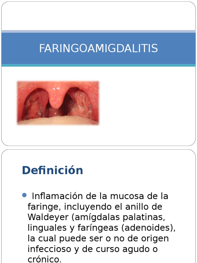 faringoamigdalitis | Penicilina | Inmunología