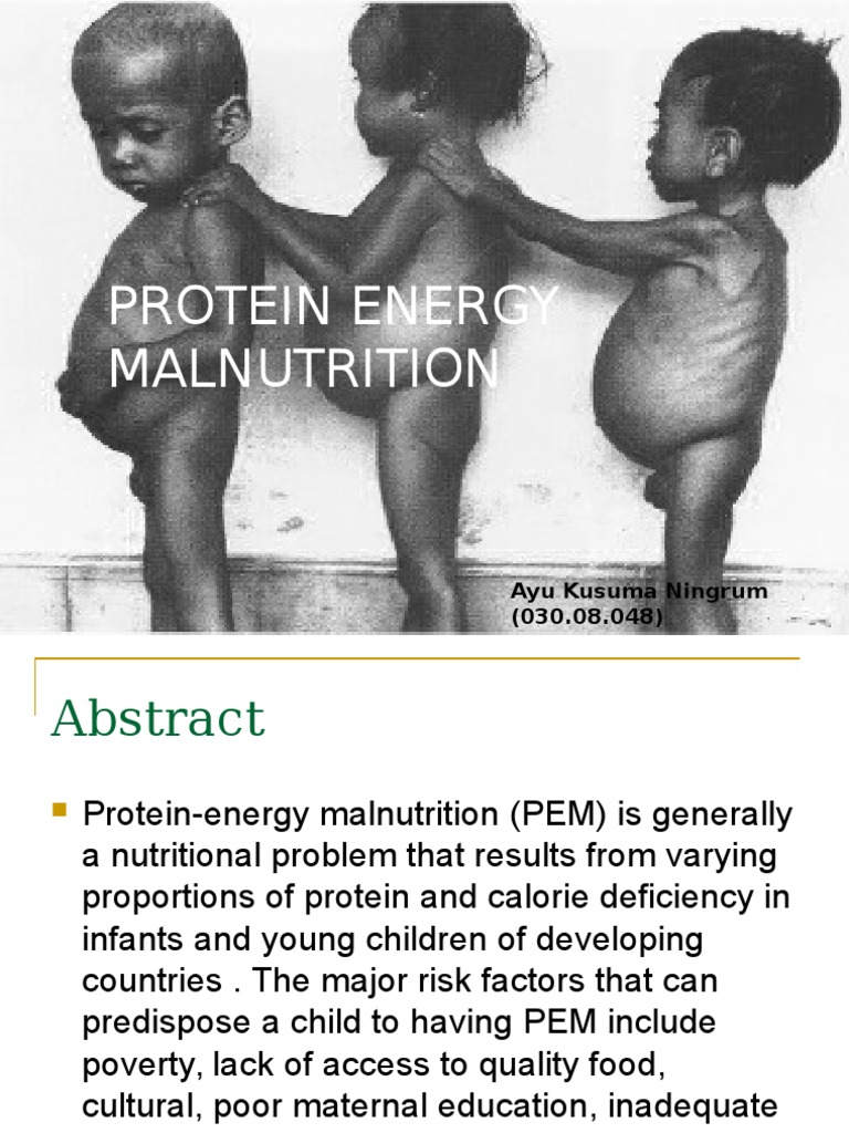 PEM | PDF | Malnutrition | Health Sciences