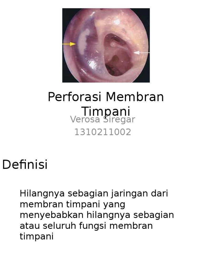 Perforasi Membran Timpani | PDF | Pengembangan Diri | Kesehatan Holistik